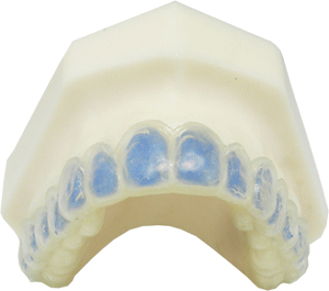 Orthodontic Appliances | POL Orthodontic Laboratory