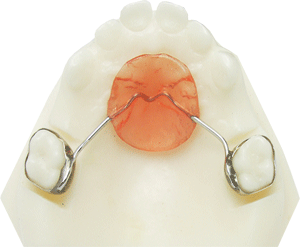 Orthodontic Appliances | POL Orthodontic Laboratory