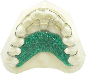 Orthodontic Appliances | POL Orthodontic Laboratory